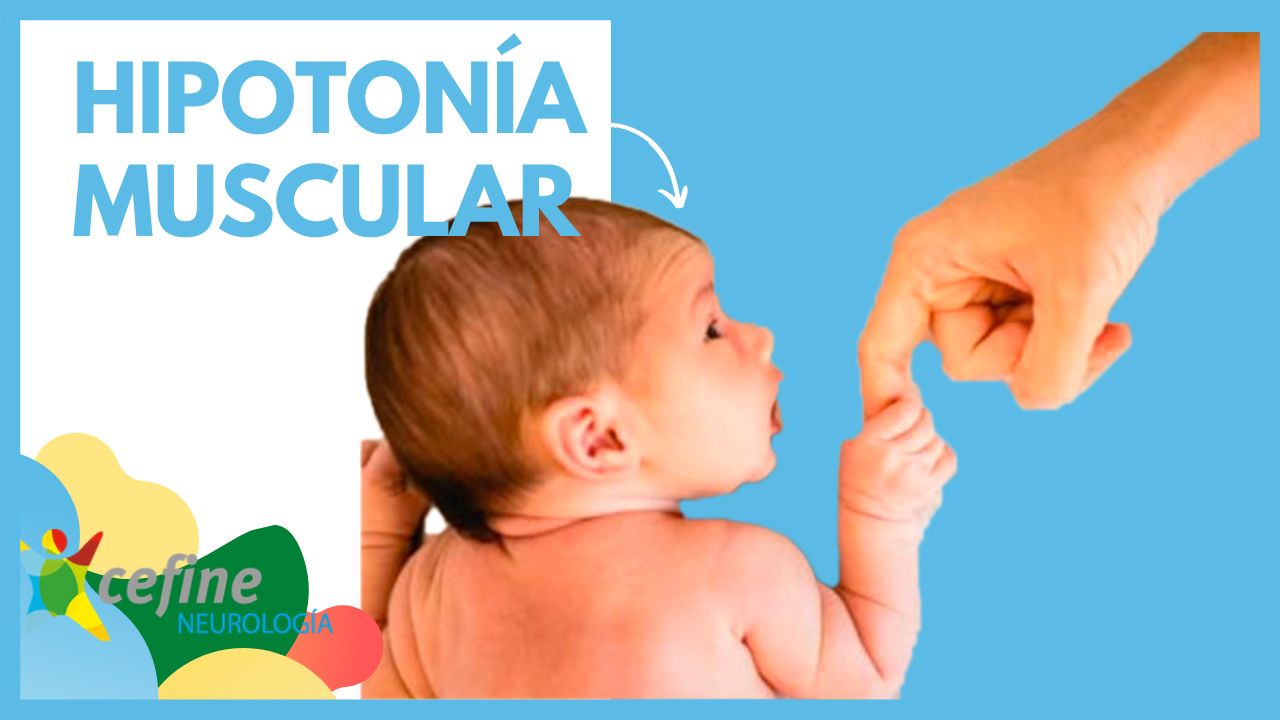 Hipotonía muscular en bebés – Qué es, cómo se detecta y qué tratamiento ...